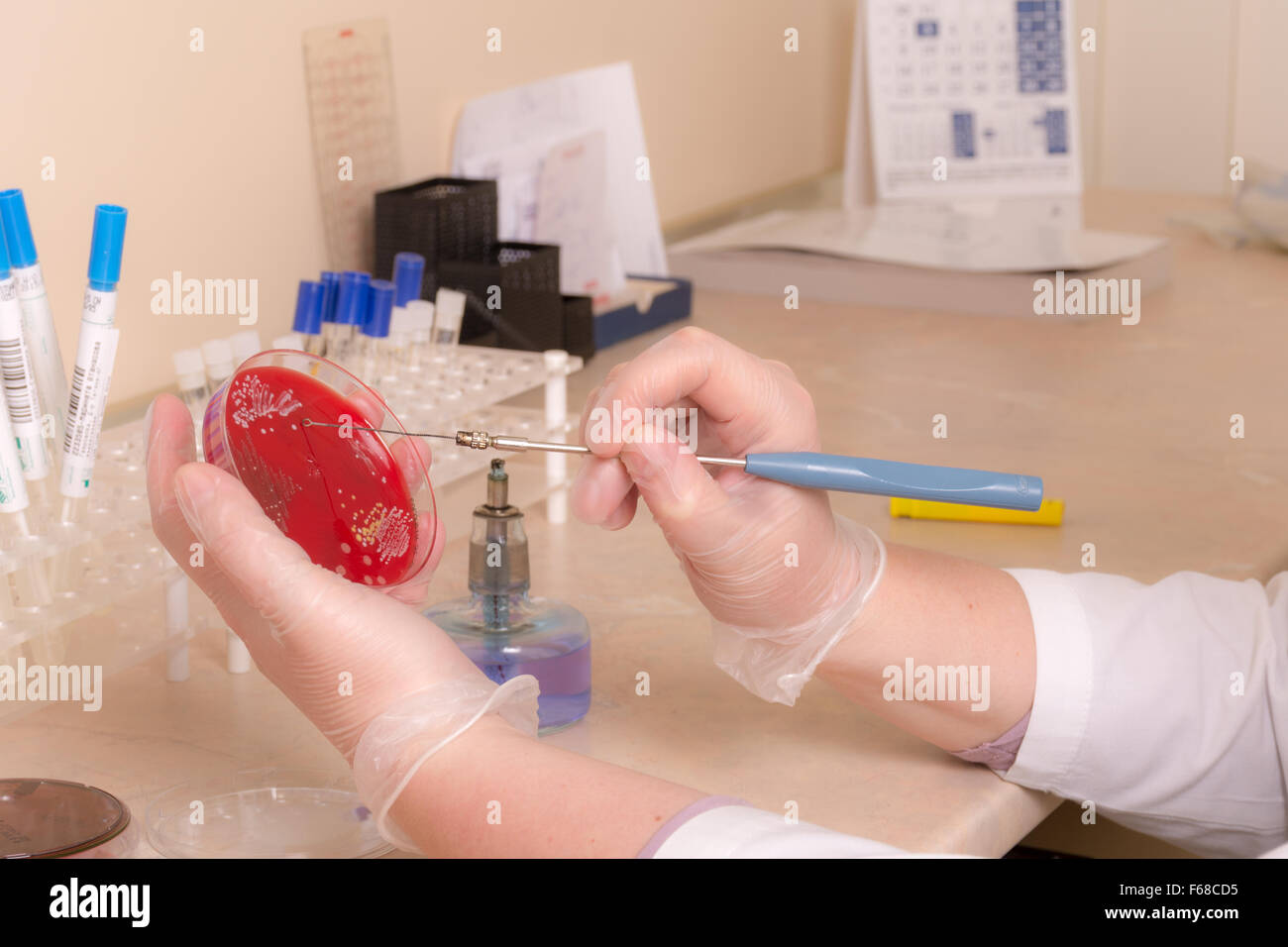 Testing of blood samples for diseases and hormones Stock Photo - Alamy