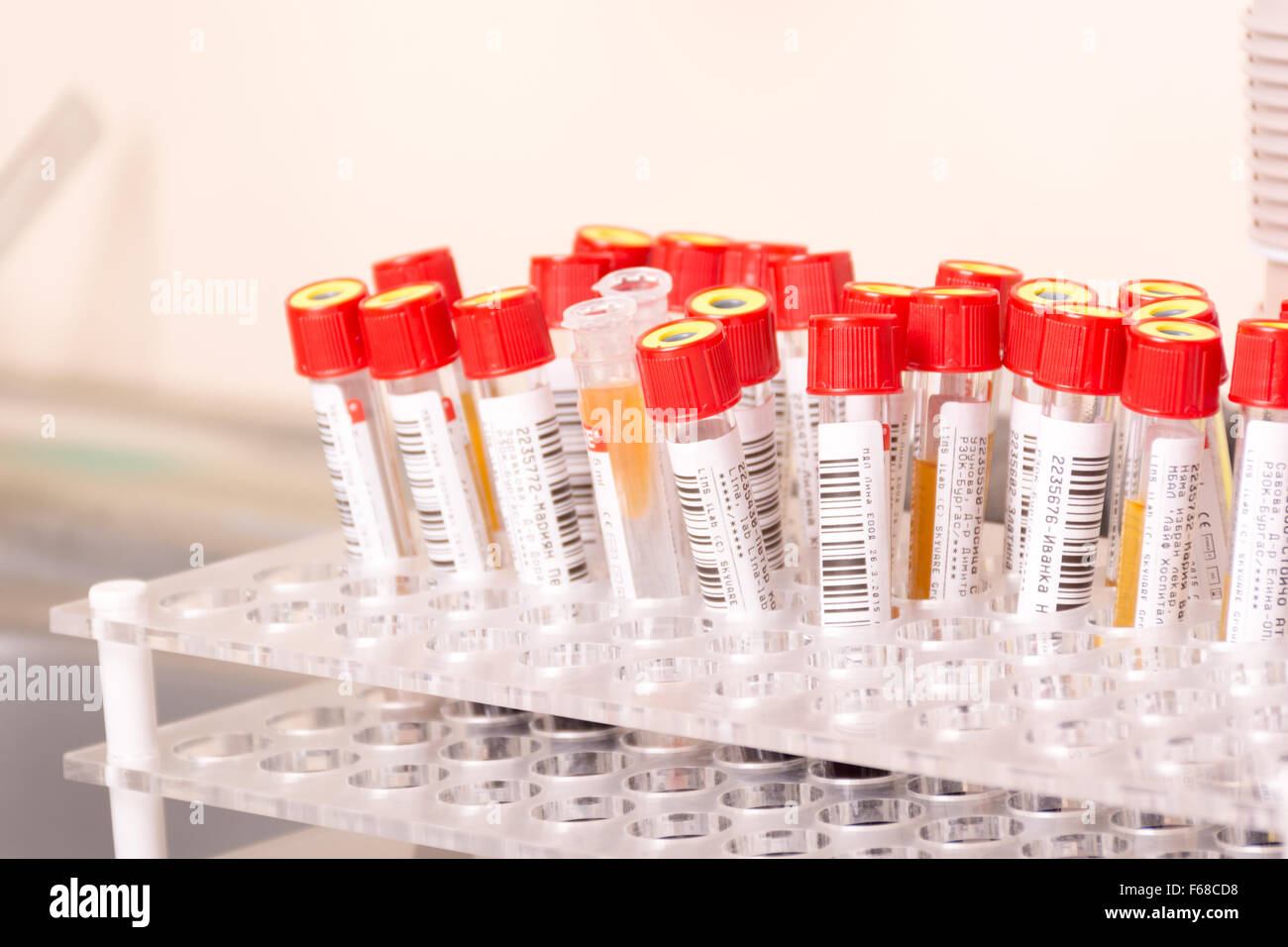 Testing of blood samples for diseases and hormones Stock Photo - Alamy