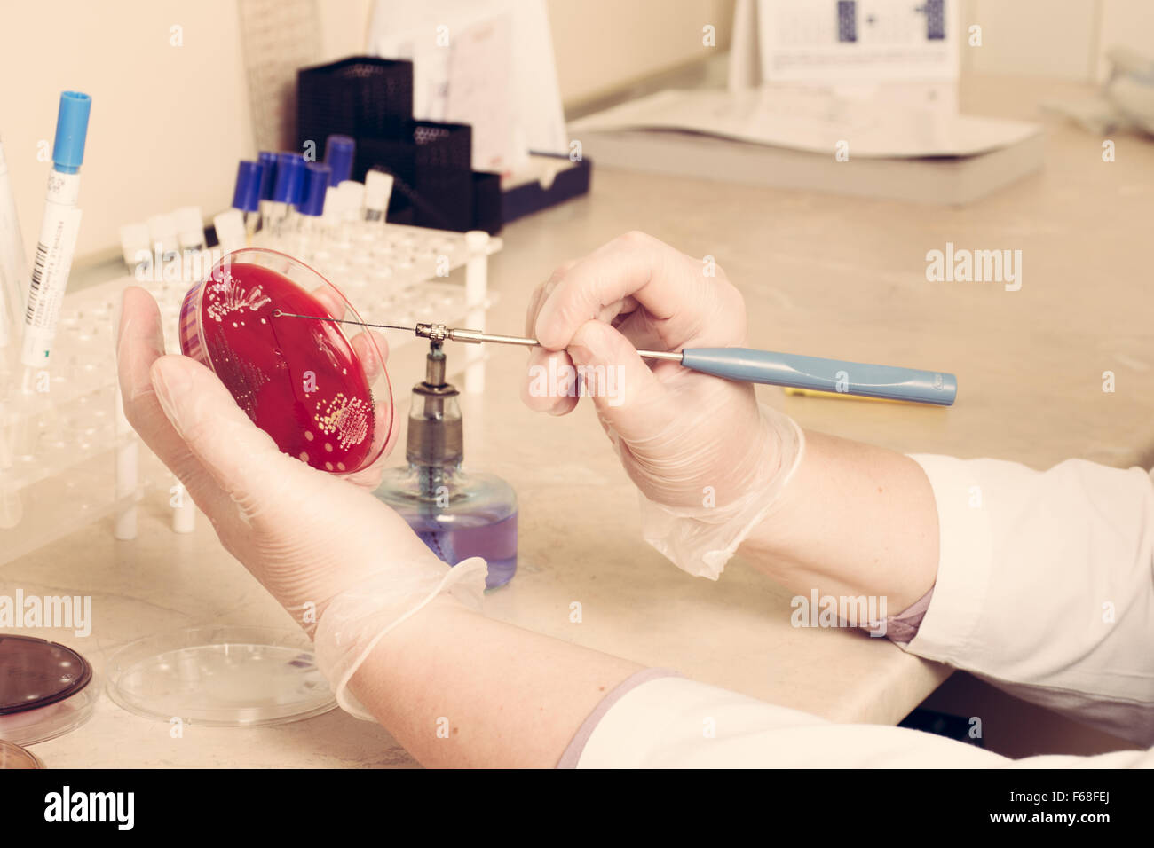 Testing of blood samples for diseases and hormones Stock Photo - Alamy
