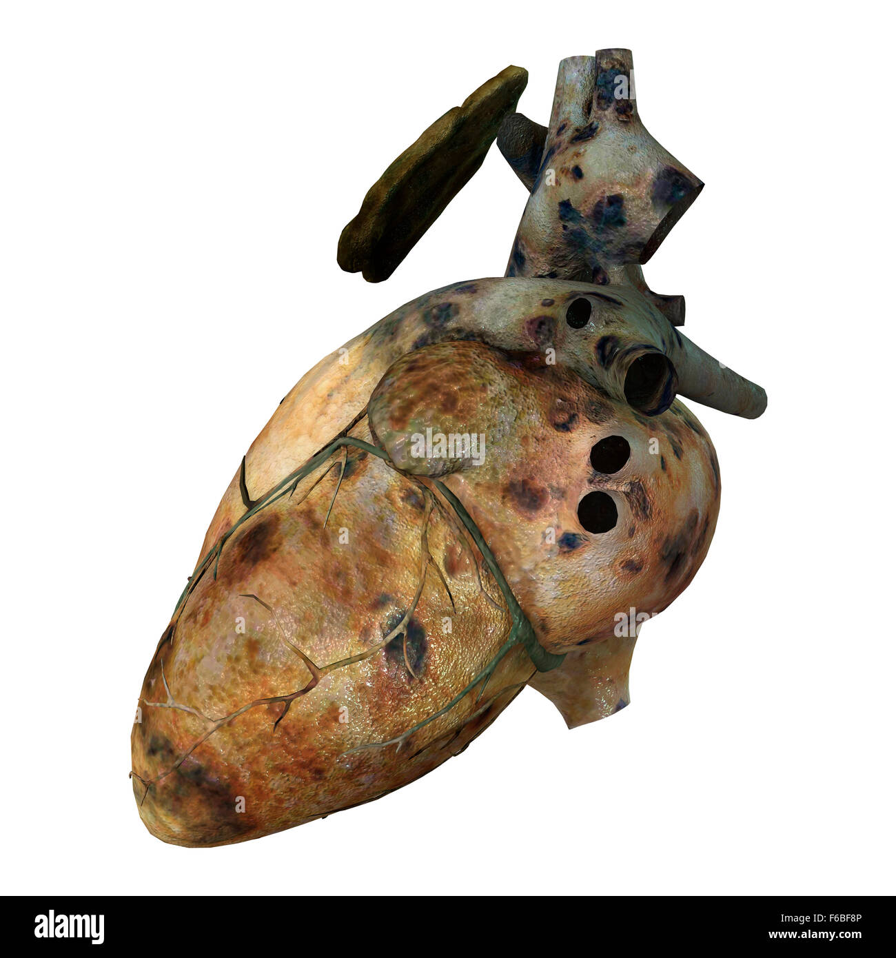 3D digital render of a sick human heart isolated on white background ...