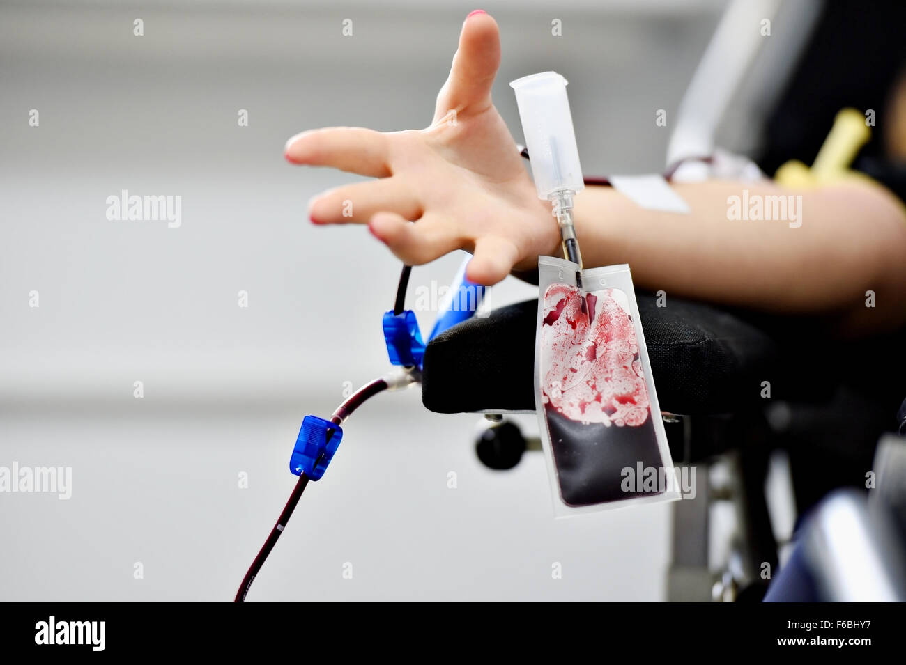 Detail with the hand of a blood donor and a plastic blood bag in a ...