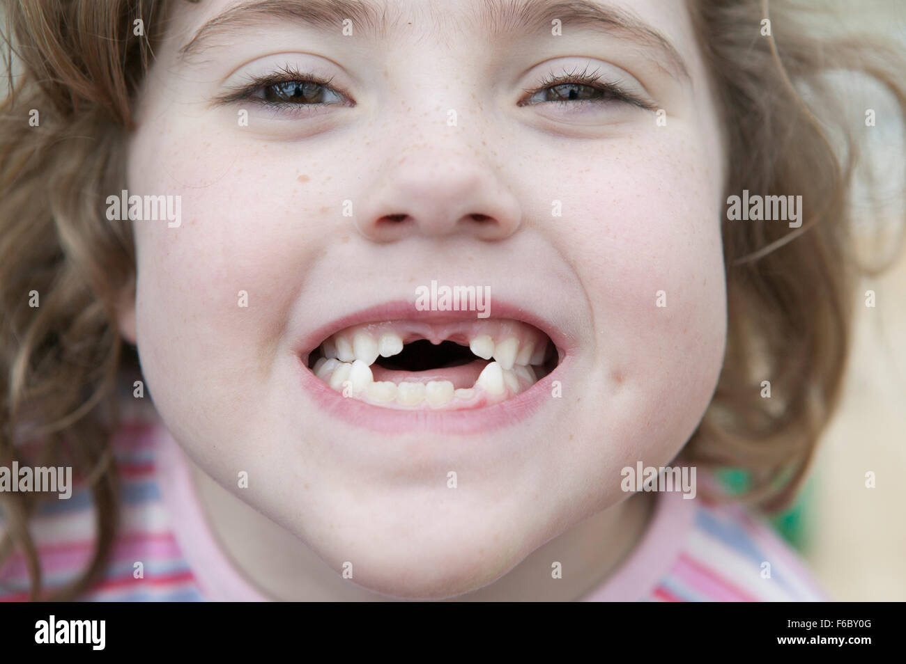 Gappy Smile High Resolution Stock Photography and Images - Alamy