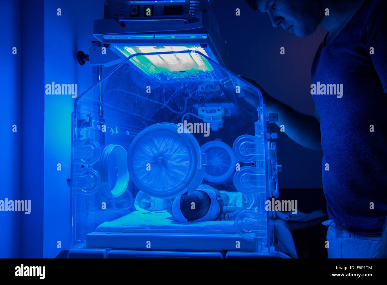 Newborn Baby having UVB phototherapy treatment for jaundice in hospital ...