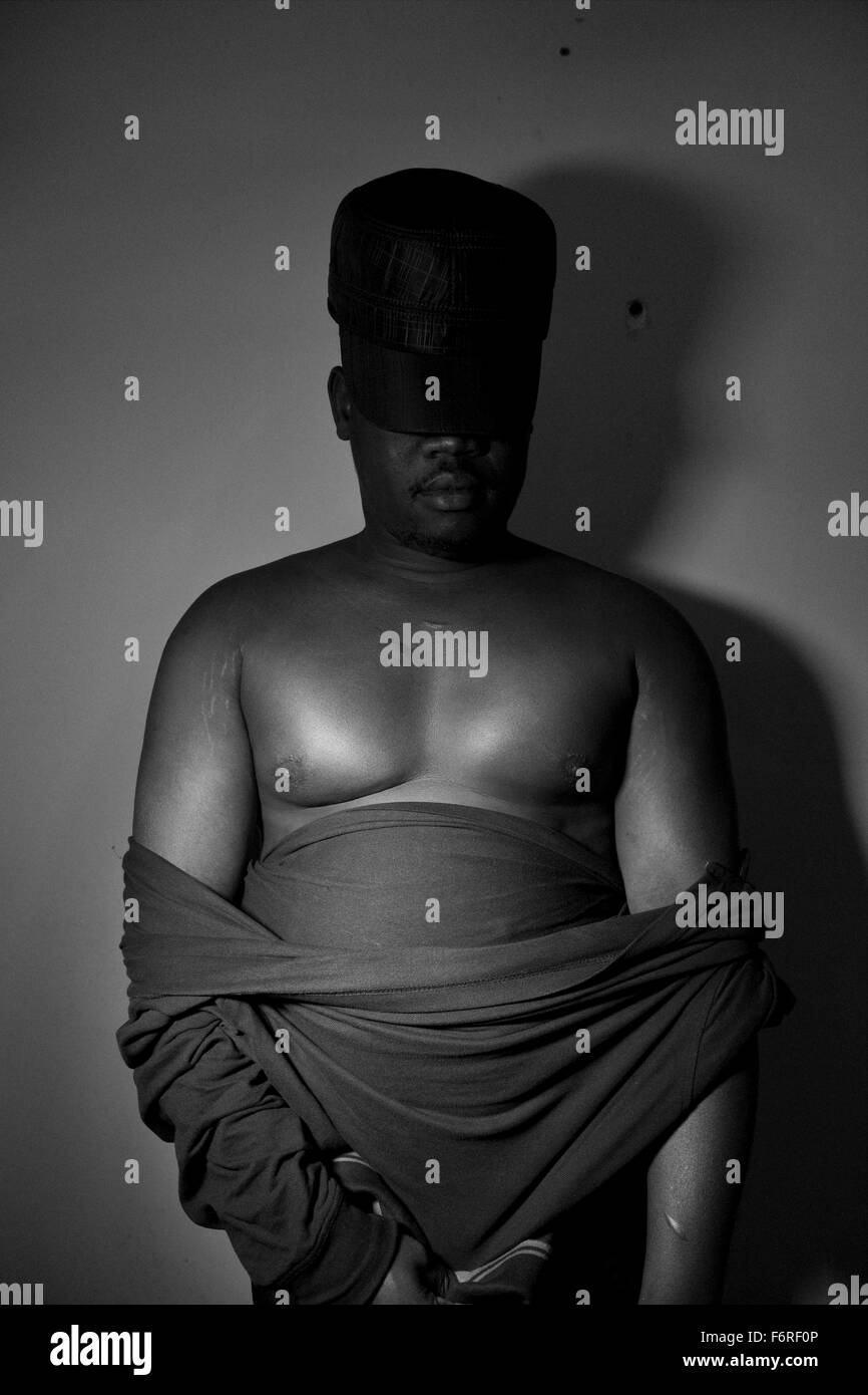 Italy, Robbio, refugee center, Immigrant who has suffered violence ...