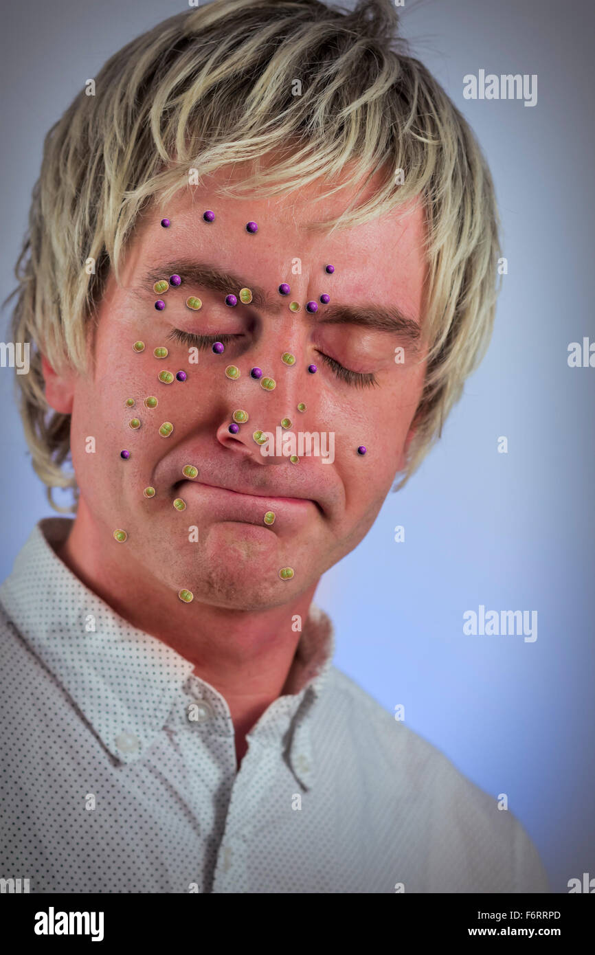 Bacteria virus sickness on blonde haired man's face Stock Photo - Alamy