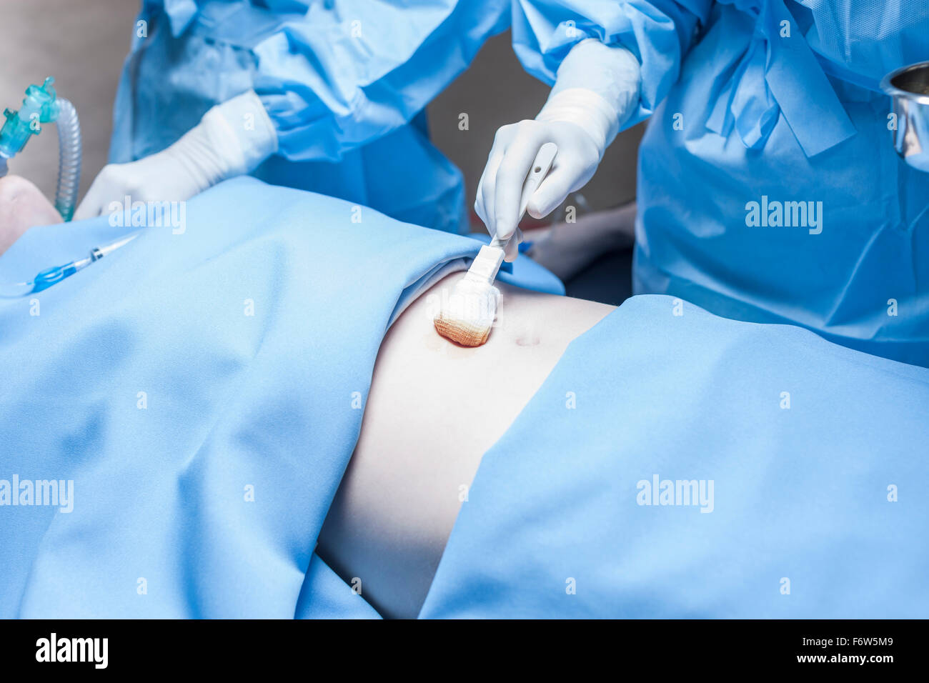 Surgery preparation hi-res stock photography and images - Alamy