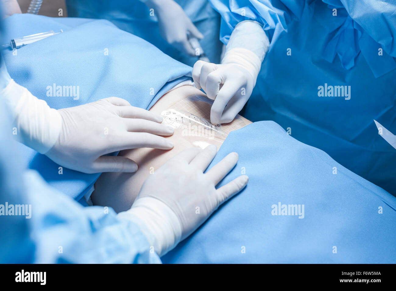 Surgery preparation hi-res stock photography and images - Alamy