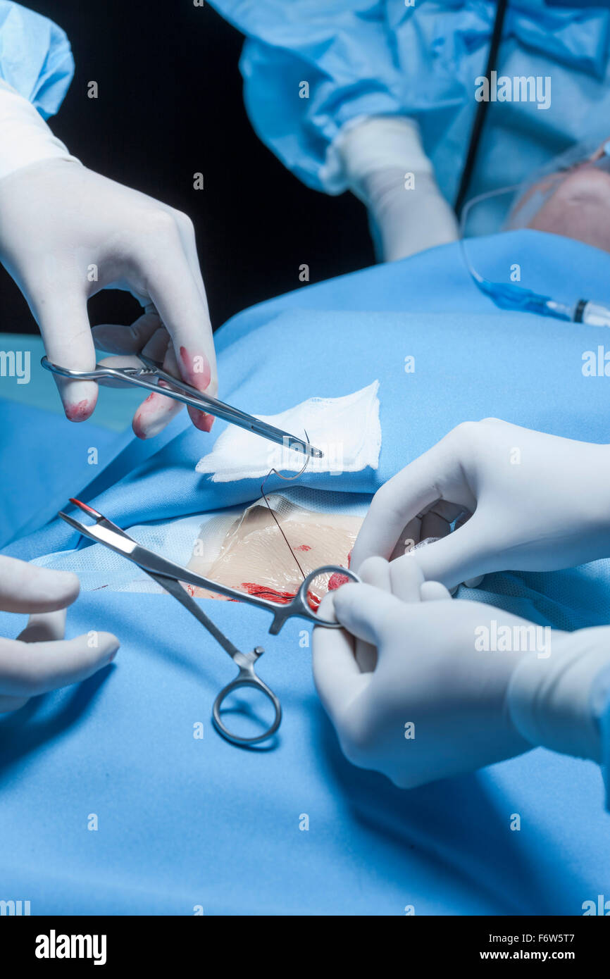 Abdomen operation hi-res stock photography and images - Alamy