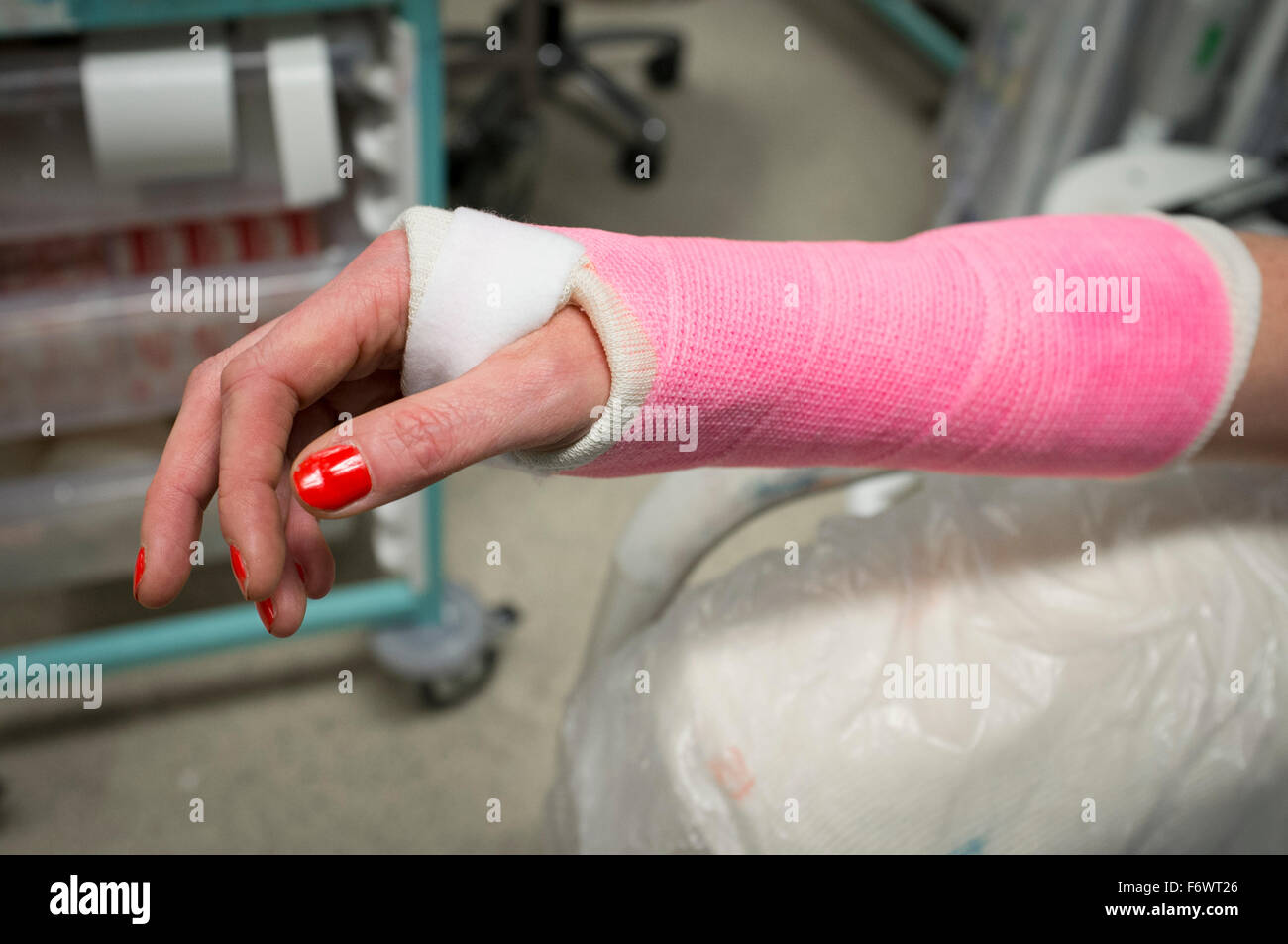 Freshly plastered lady's wrist in a pink plaster cast in a hospital ...