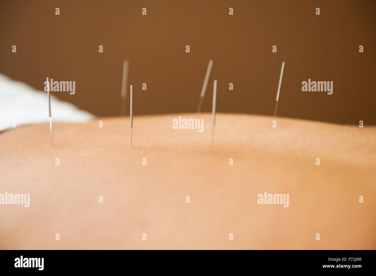 Human physical therapy hi-res stock photography and images - Alamy