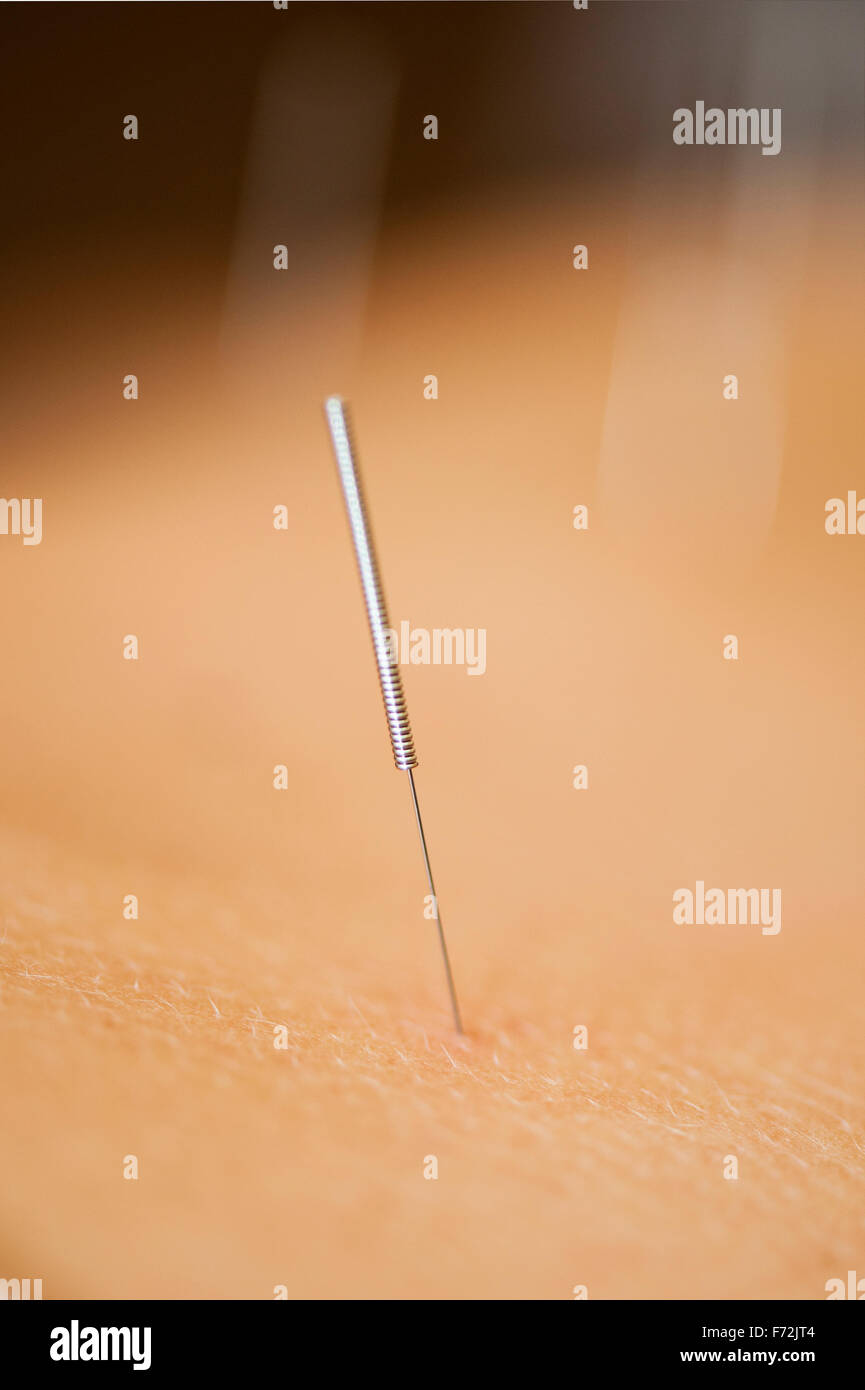 Human physical therapy hi-res stock photography and images - Alamy