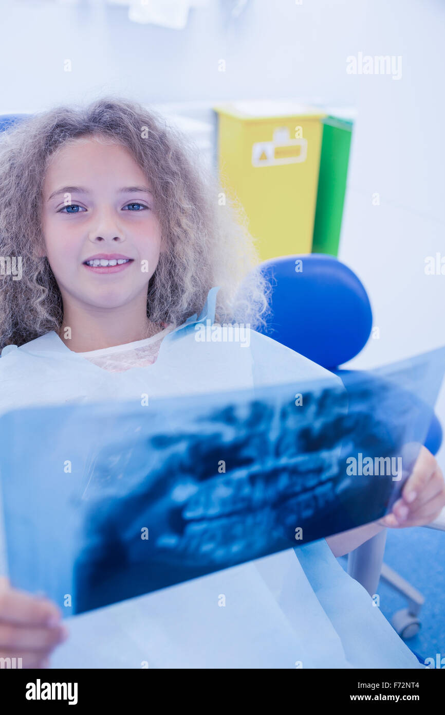 Smiling young patient holding x-ray Stock Photo - Alamy