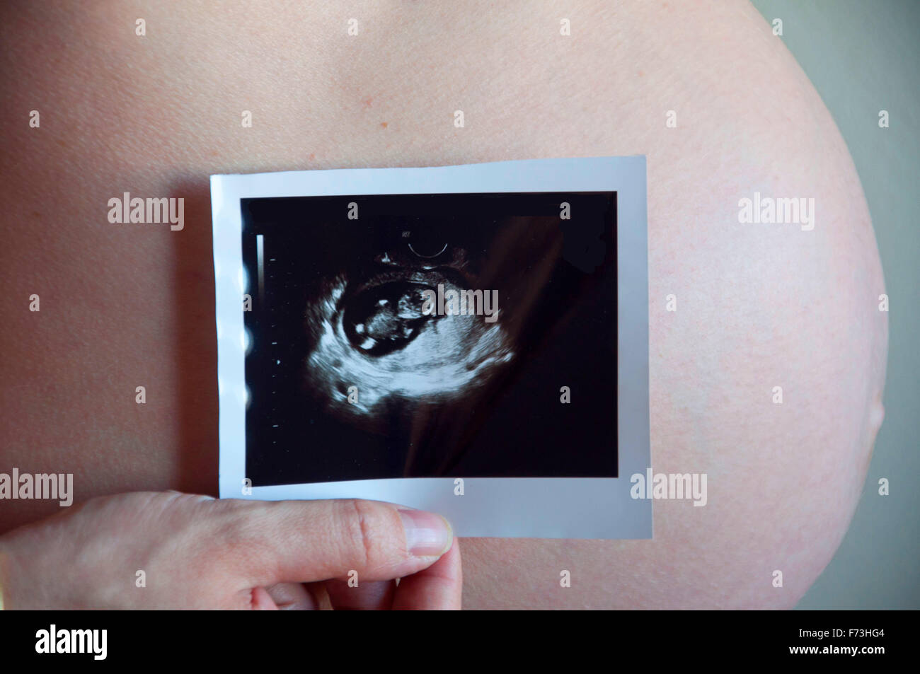 Baby bump and ecography of the baby Stock Photo - Alamy