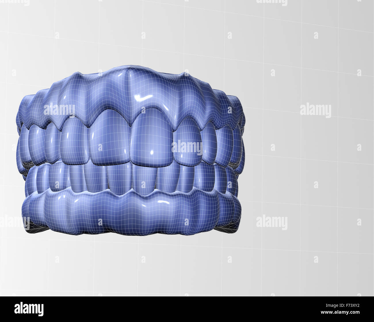 Open denture hi-res stock photography and images - Alamy