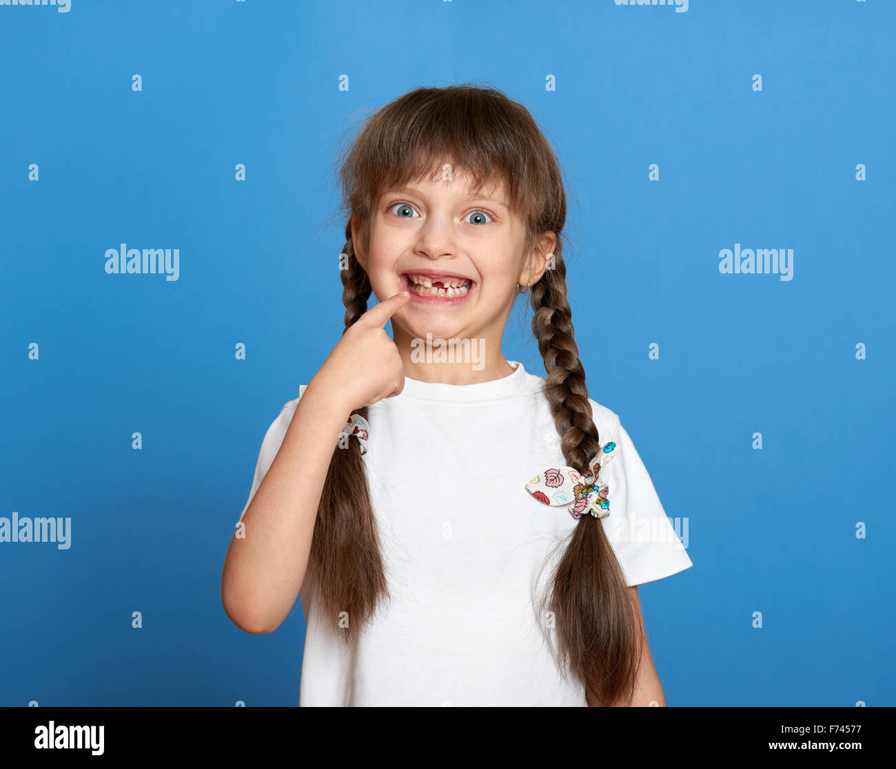 happy lost tooth girl portrait, studio shoot on blue background Stock ...
