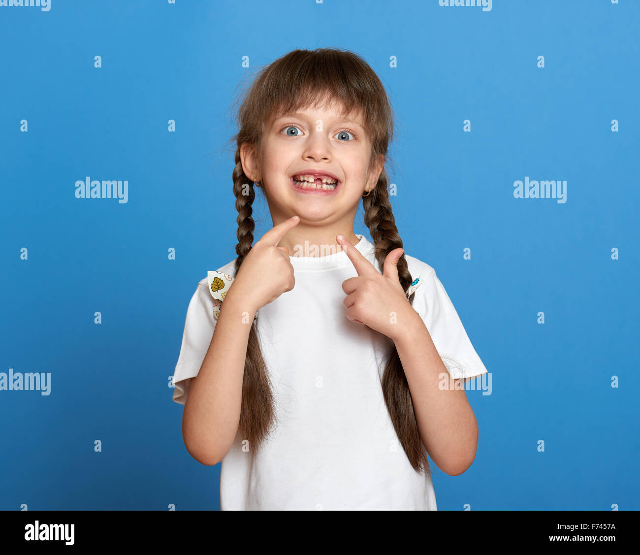 happy lost tooth girl portrait, studio shoot on blue background Stock ...