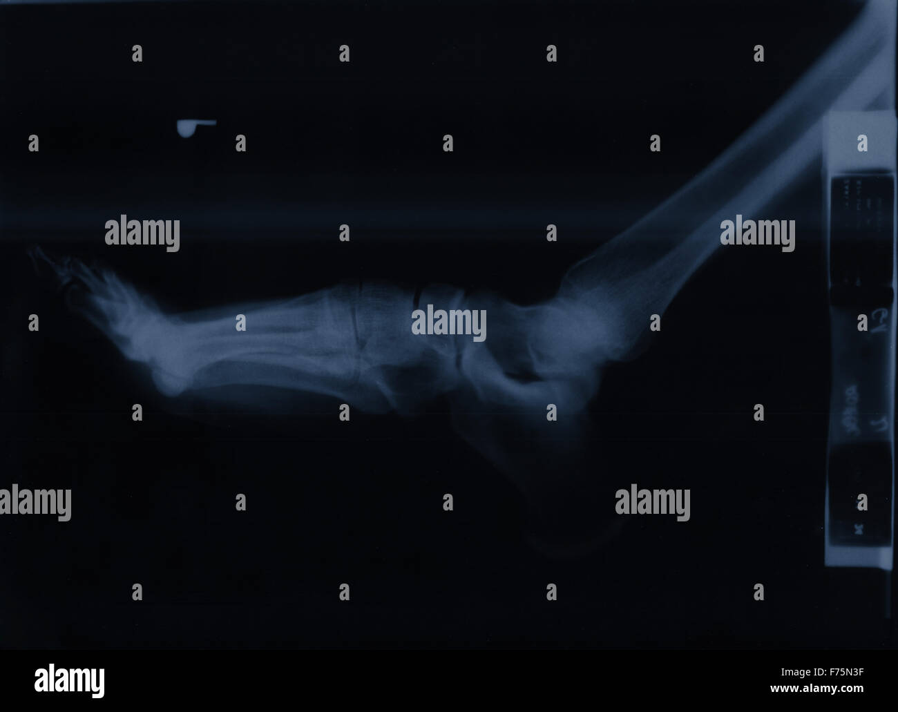 Human x ray hi-res stock photography and images - Alamy