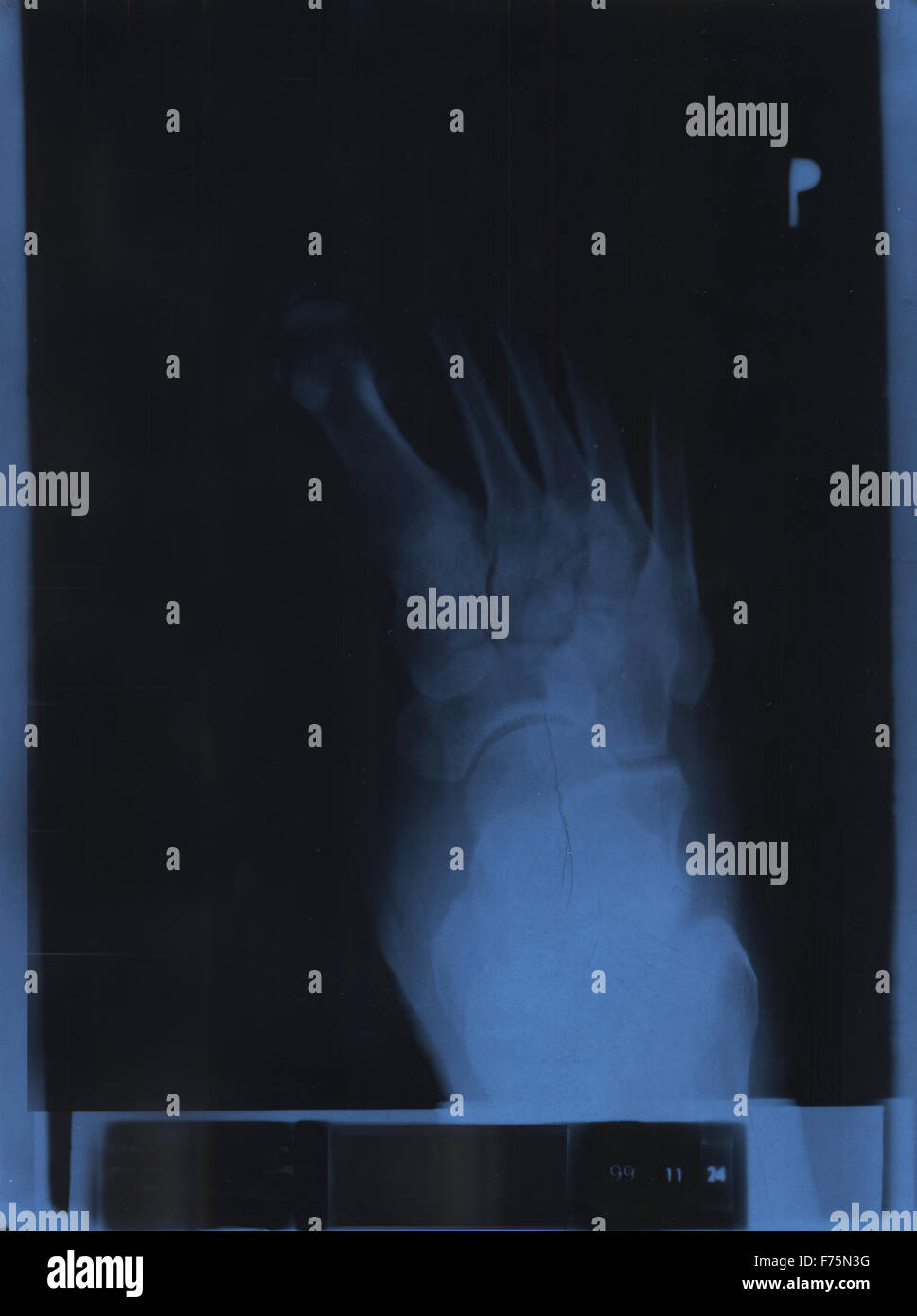 Human x ray hi-res stock photography and images - Alamy