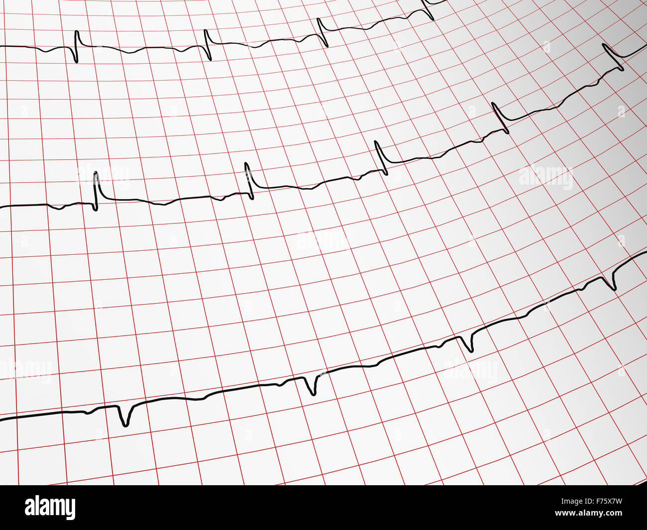 EKG Stock Photo - Alamy