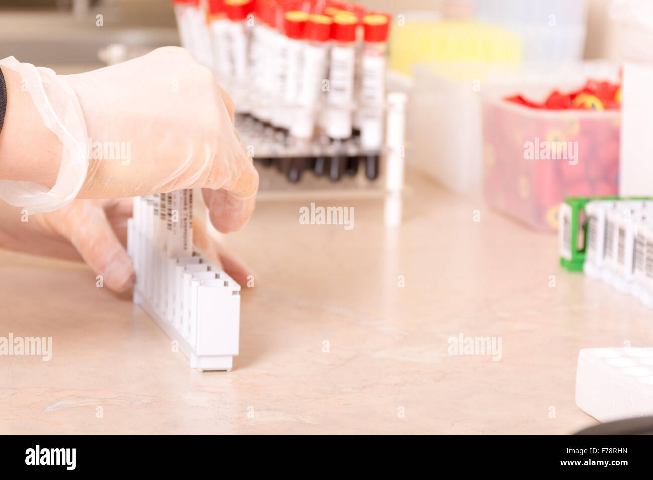 Reproductive assistance techniques and spermiogram in laboratory Stock ...