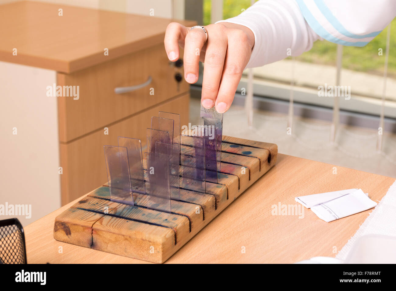 Testing of blood samples for diseases and hormones Stock Photo - Alamy
