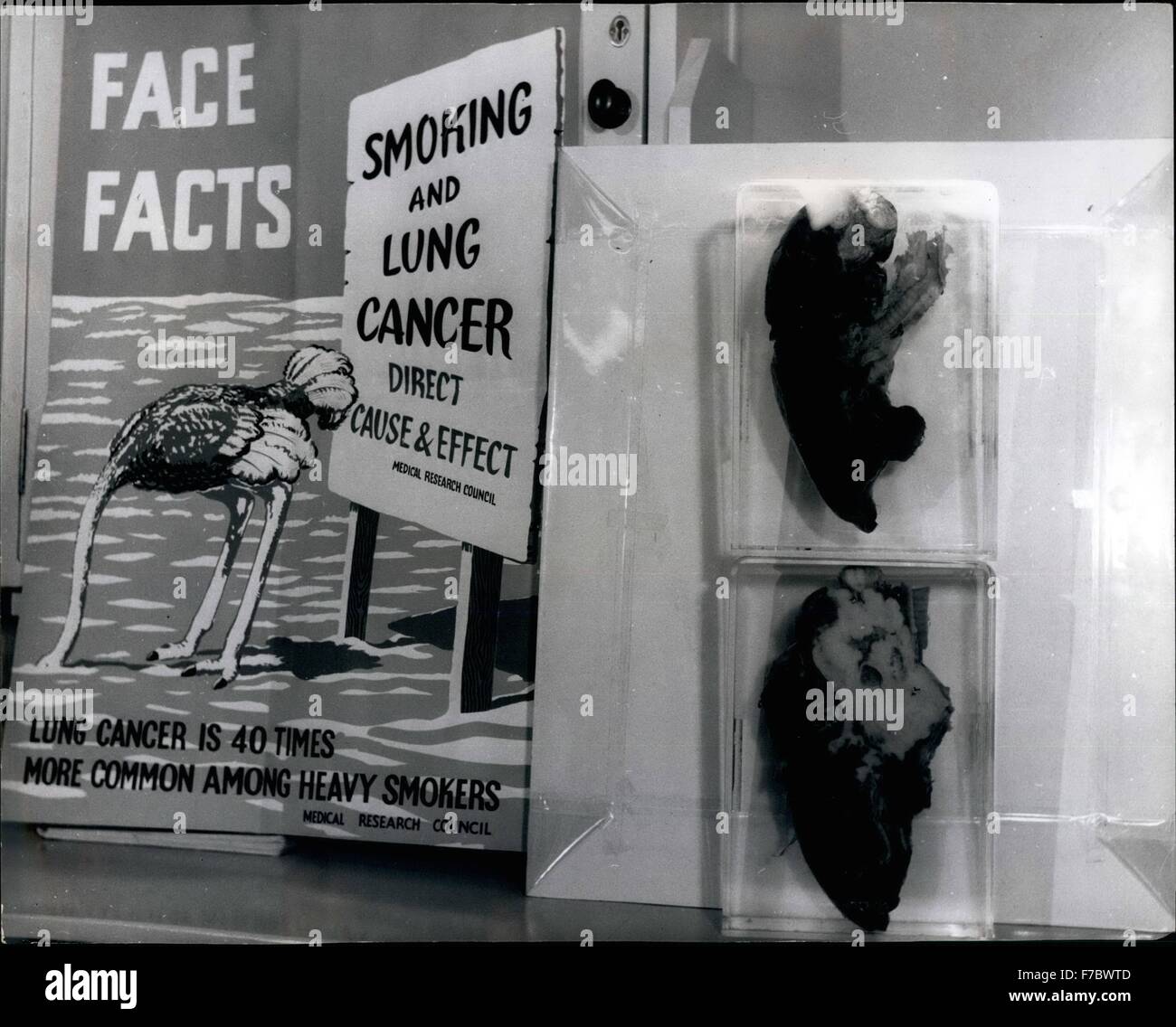 Who died of lung cancer hi-res stock photography and images - Alamy