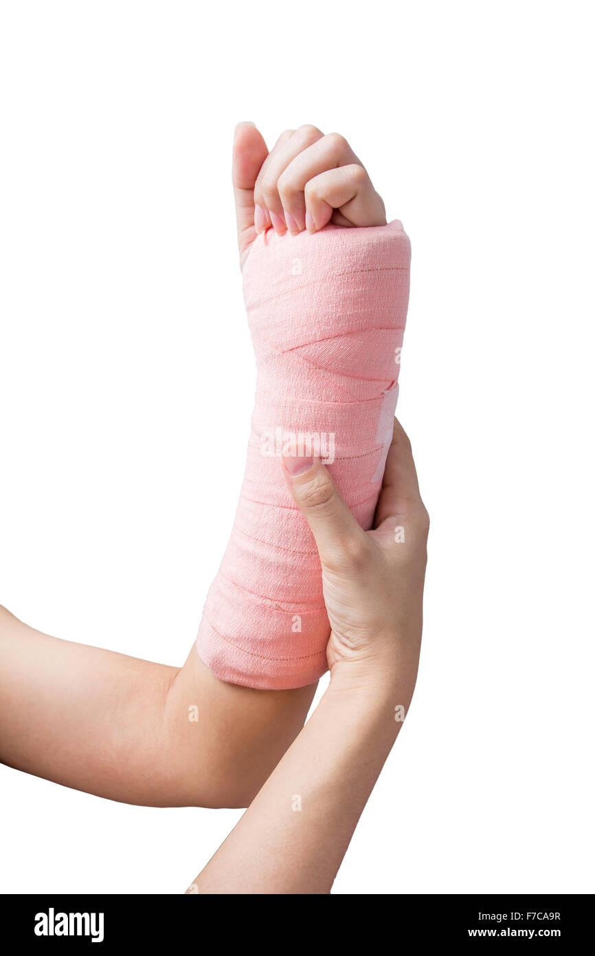 Splint,broken bone,broken hand isolate on white background Stock Photo ...