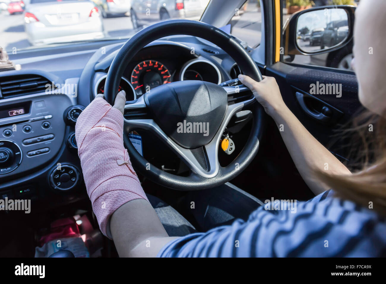 Splint hi-res stock photography and images - Alamy