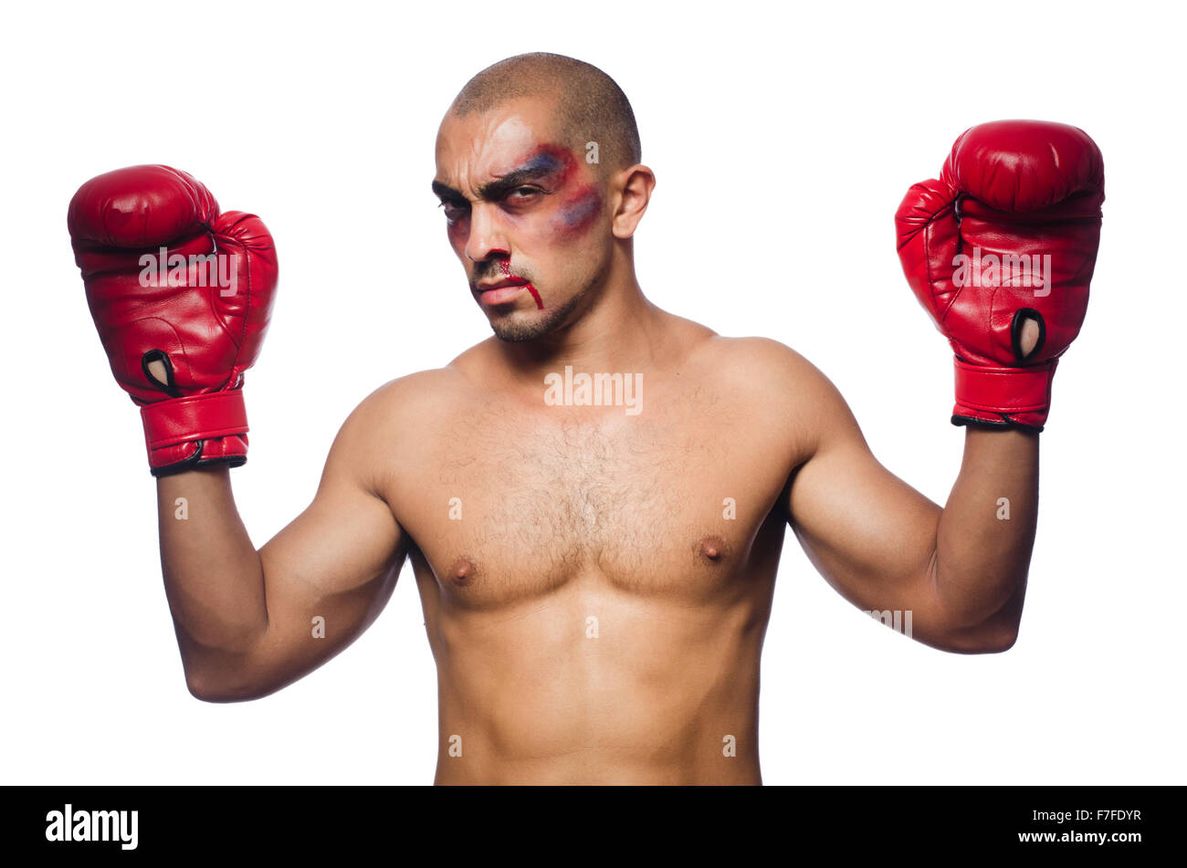 Badly beaten boxer isolated on white Stock Photo - Alamy