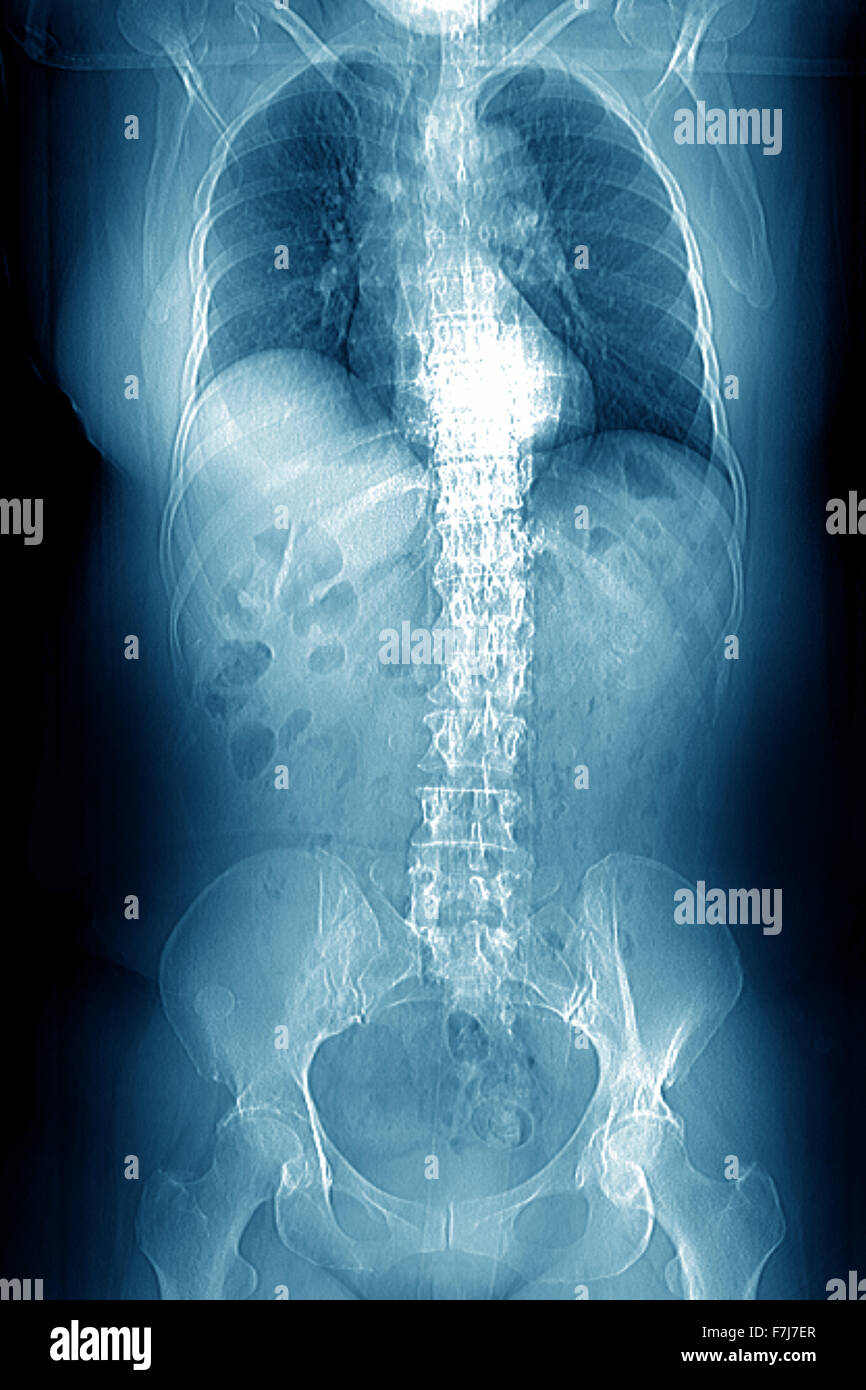 Pelvic Bone Structure High Resolution Stock Photography and Images - Alamy