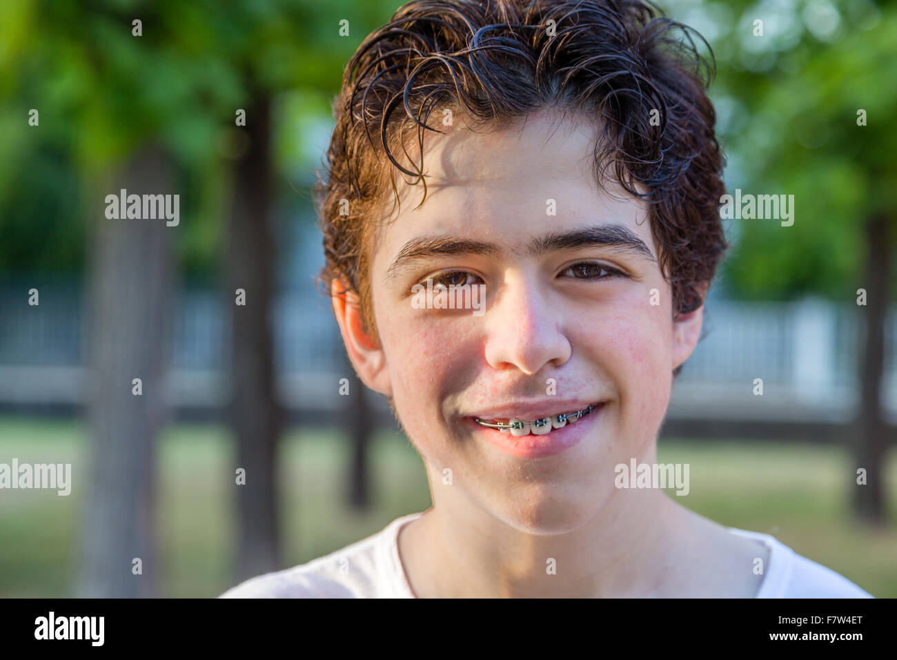 teenager with acne skin smiling while showing braces with trees in the ...