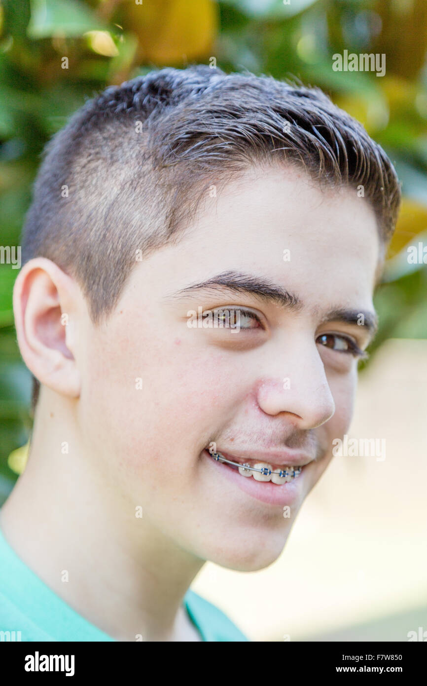 boy with pimples and dermatitis, skin problems typical of adolescents ...