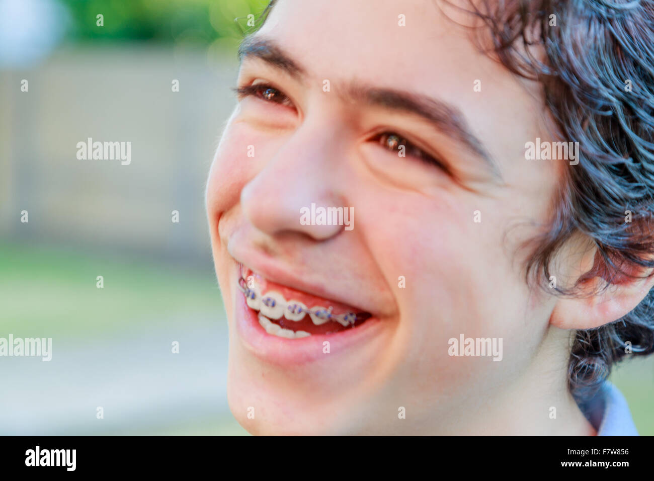 close-up of Caucasian boy smiling and showing an orthodontic appliance ...