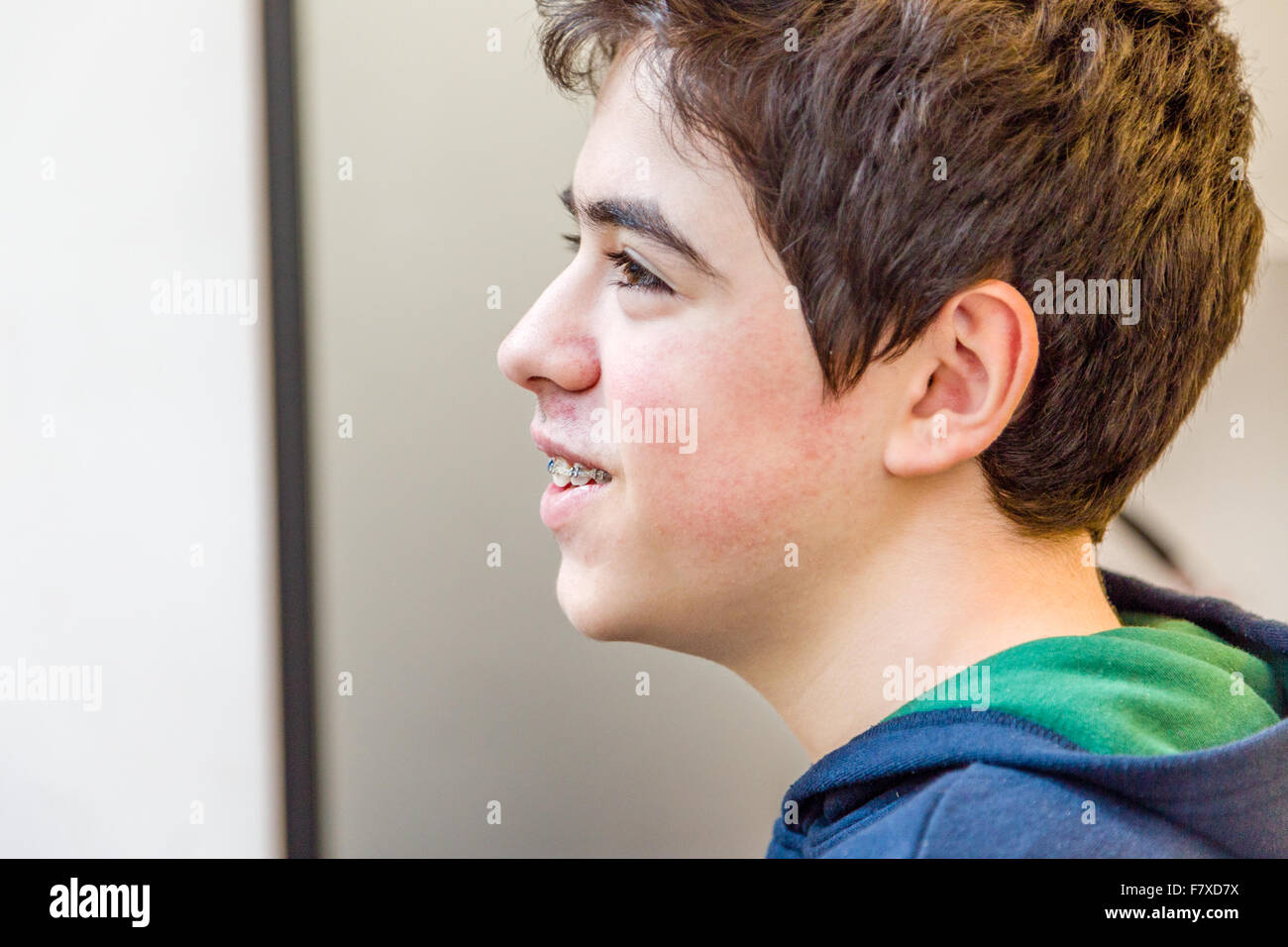 side view of caucasian boy happy and smiling with braces on teeth Stock ...