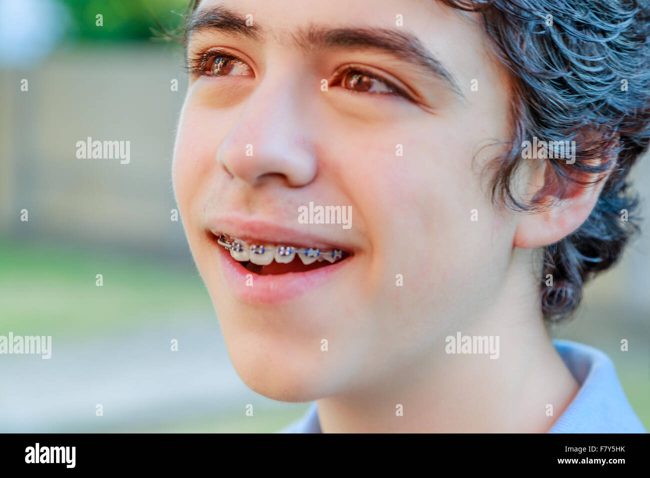 close-up of Caucasian boy with acne skin smiling and showing an ...