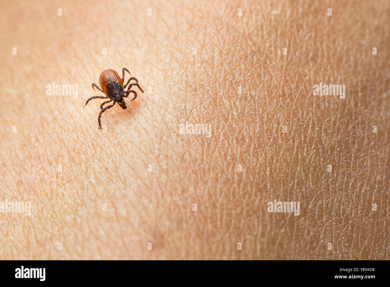 Tick - parasitic arachnid blood-sucking carrier of various diseases ...