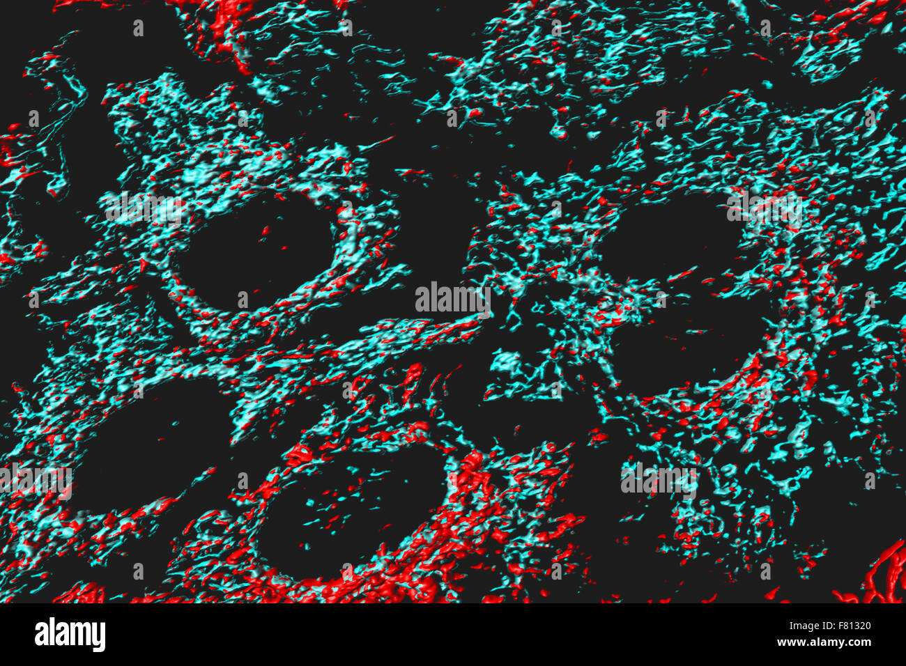 Mitochondria in HeLa cervical cancer cells Stock Photo - Alamy