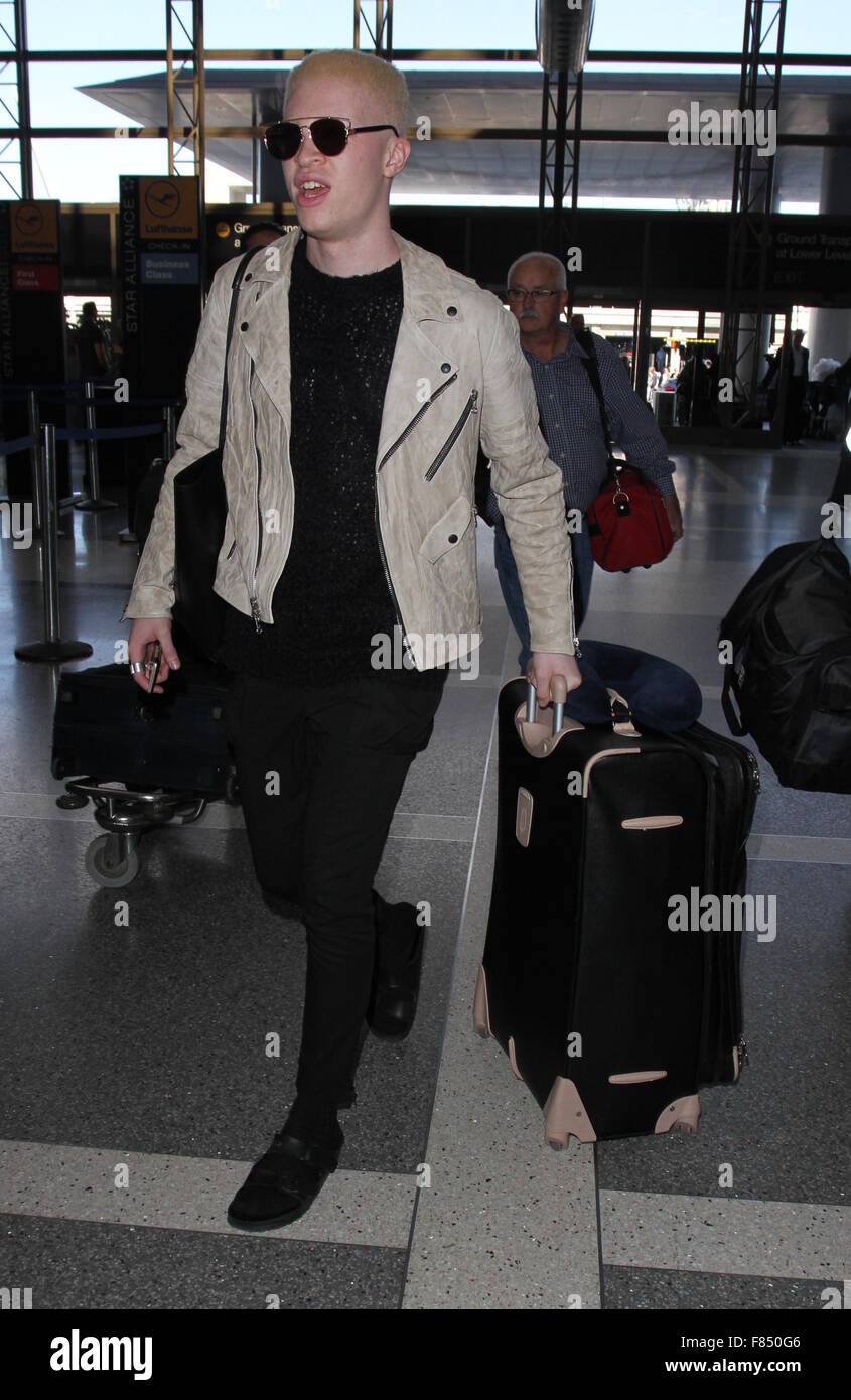 Black Albino Model Shaun Ross