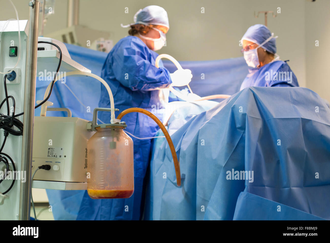 Fat removed by liposuction Stock Photo - Alamy