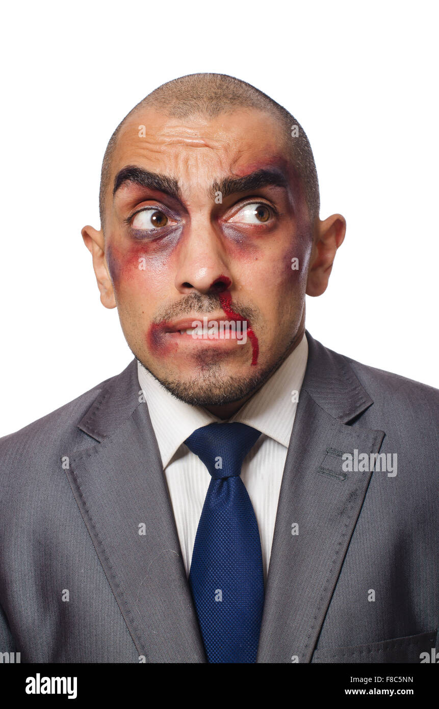 Badly beaten businessman isolated on white Stock Photo - Alamy