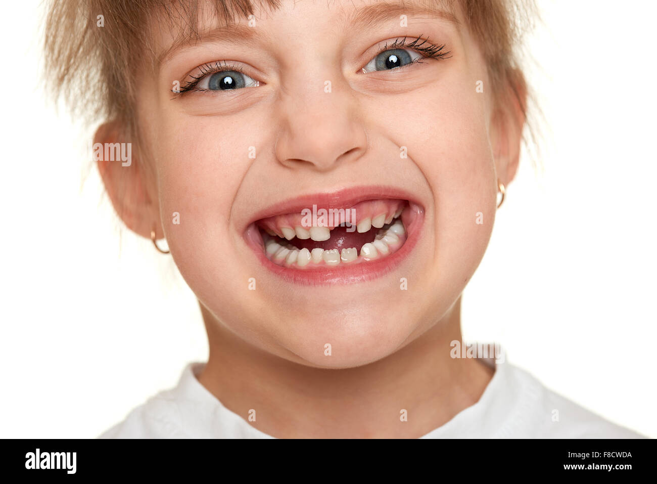 Teenager missing tooth hi-res stock photography and images - Alamy