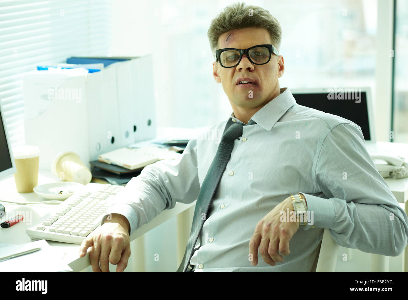 Bruised face hi-res stock photography and images - Alamy