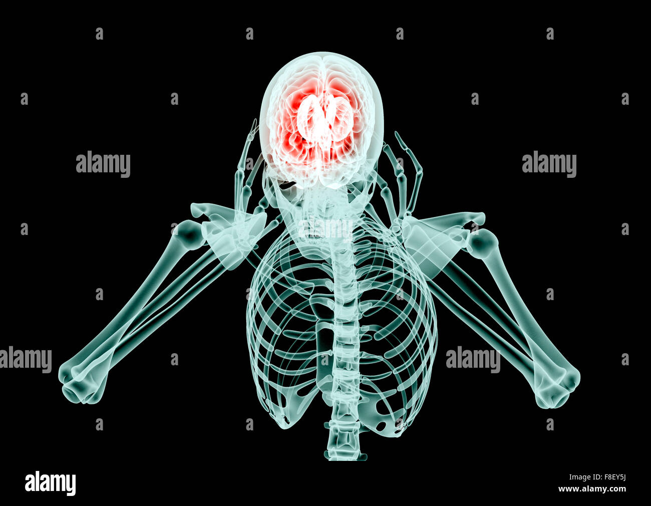 Human pain anatomy hi-res stock photography and images - Alamy