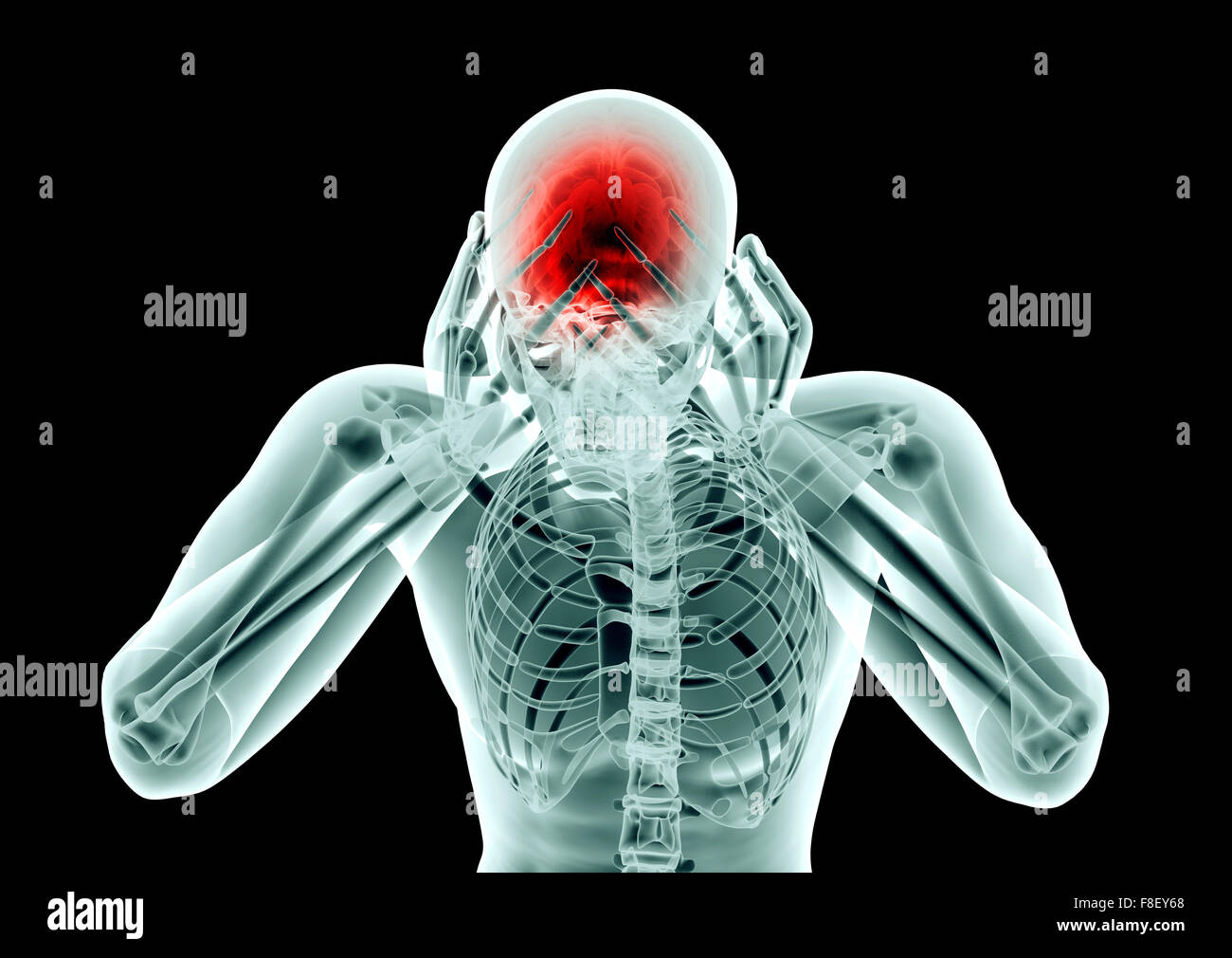 Human pain anatomy hi-res stock photography and images - Alamy