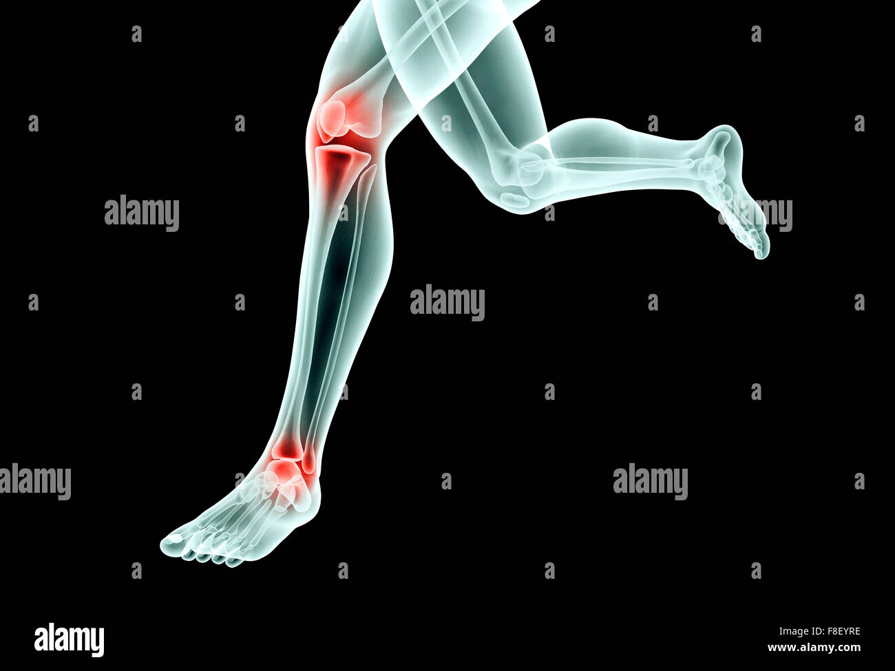 x-ray image of a man with pain on black with clipping path Stock Photo ...