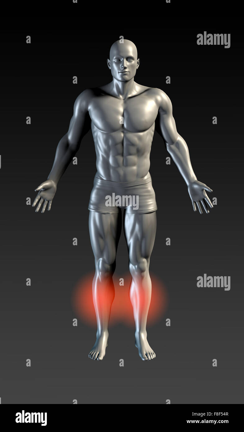 Shin Splints with Red Glow on Area Series Stock Photo - Alamy