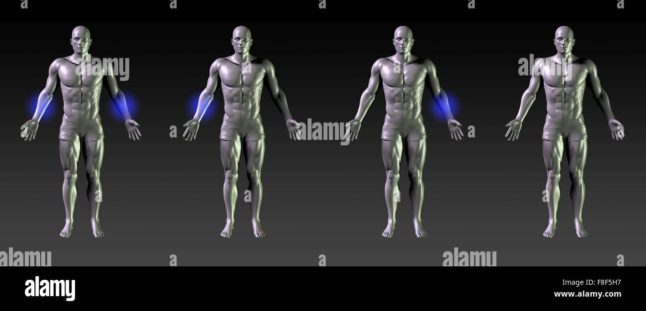 Forearm Recovery or Rehabilitation with Blue Glow Stock Photo - Alamy