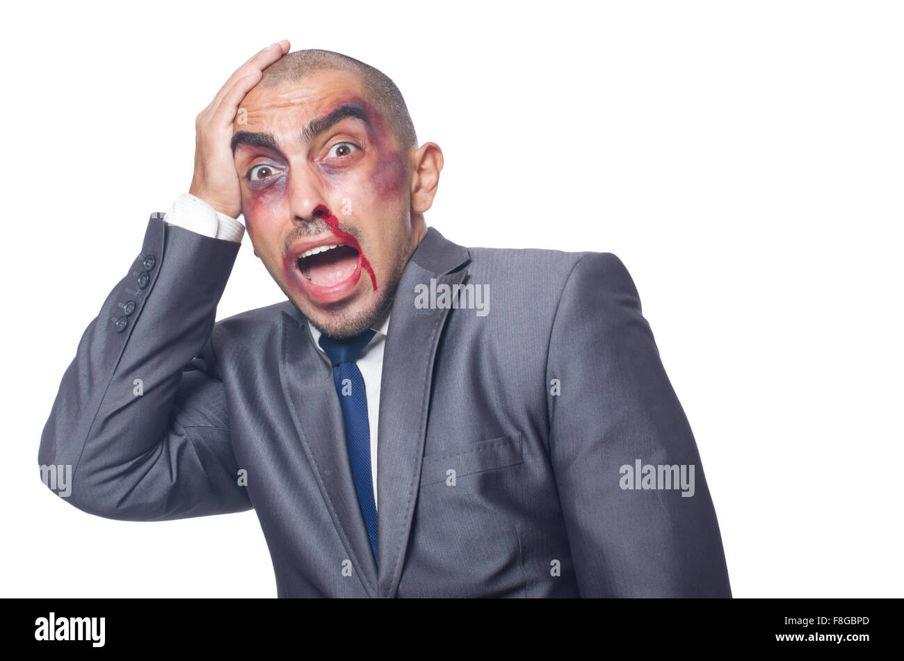 Badly beaten businessman isolated on white Stock Photo - Alamy