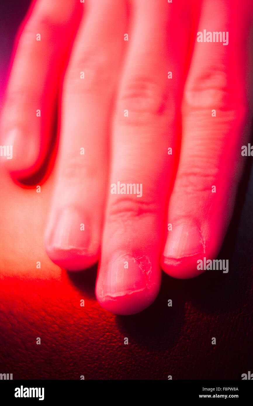 Patient hand in red physiotherapy heat treatment under hot light Stock ...