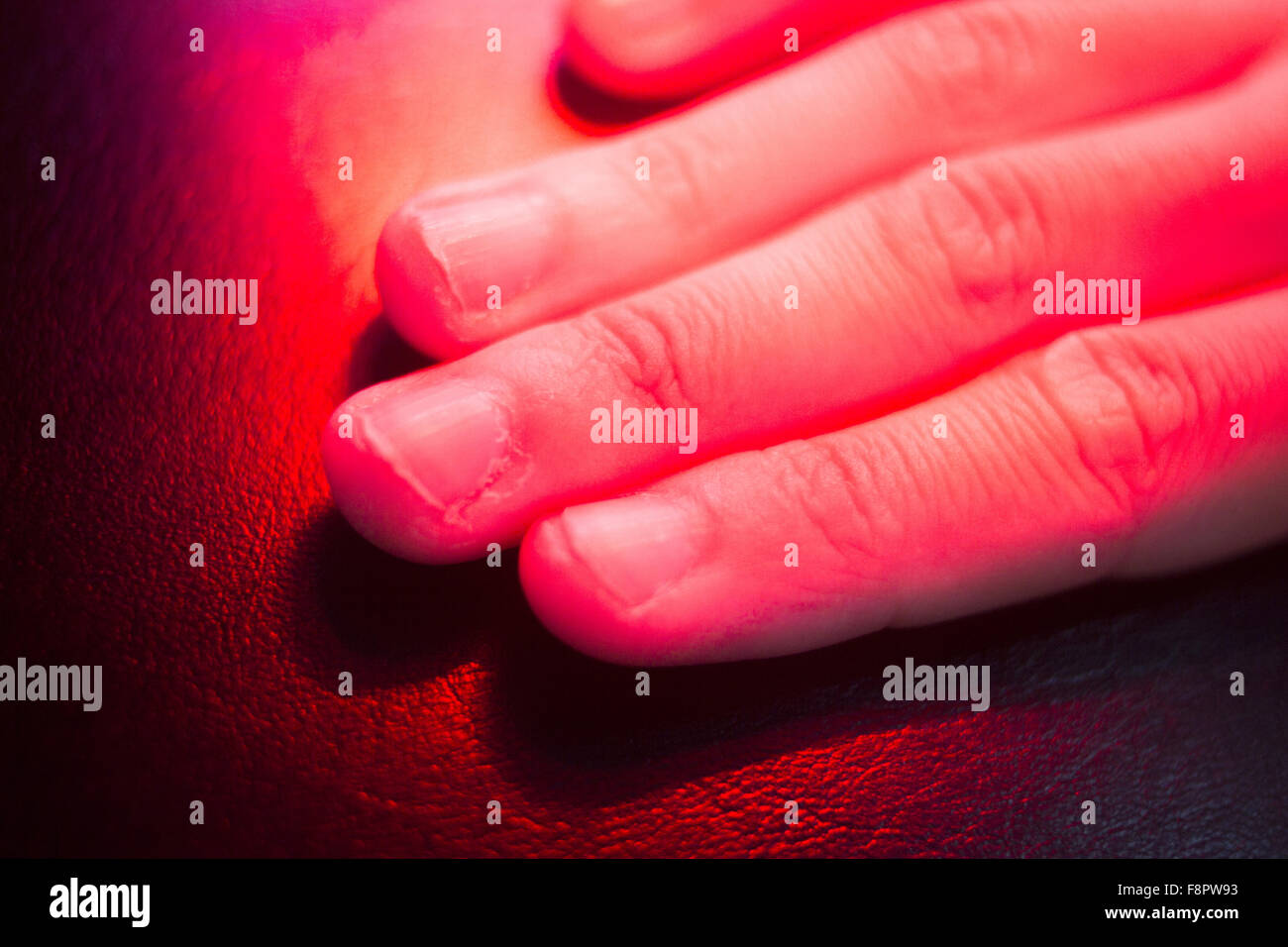 Patient hand in red physiotherapy heat treatment under hot light Stock ...